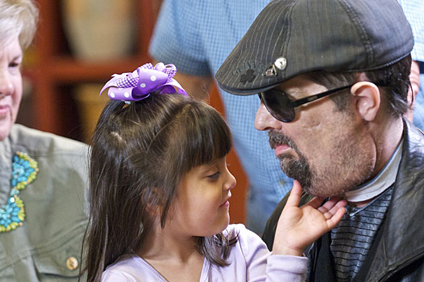 First U.S. full face transplant patient — Harvard Gazette